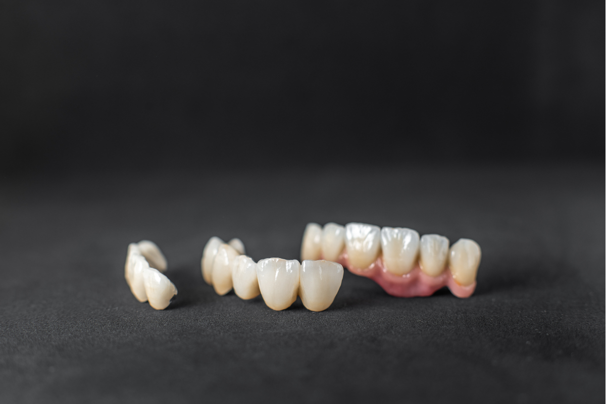 A Guide to Properly Maintain Your Dental Crowns